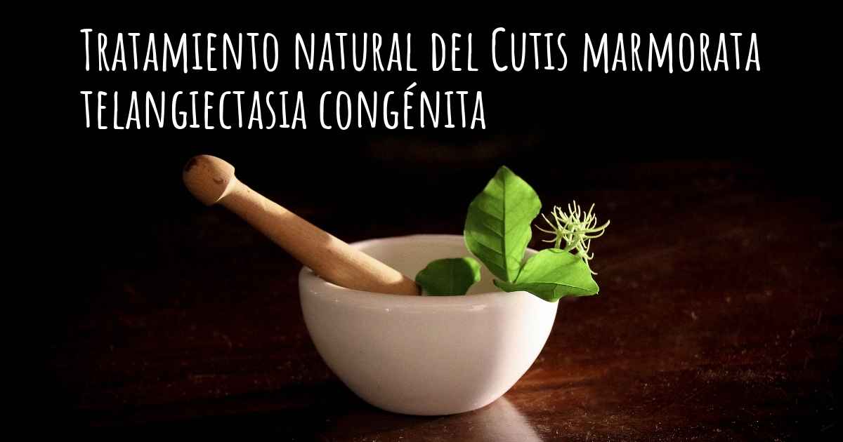 ¿Existe algún tratamiento natural para el Cutis marmorata ...